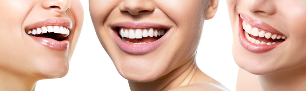 Did you Know Smiling Every Day is Good for You? - The Tooth Spa